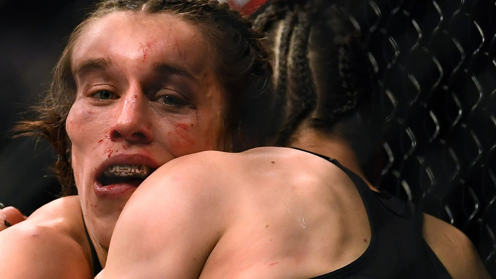 UFC 248: Jedrzejczy's face a week after it was pummelled - Foto 2 de 25 ...